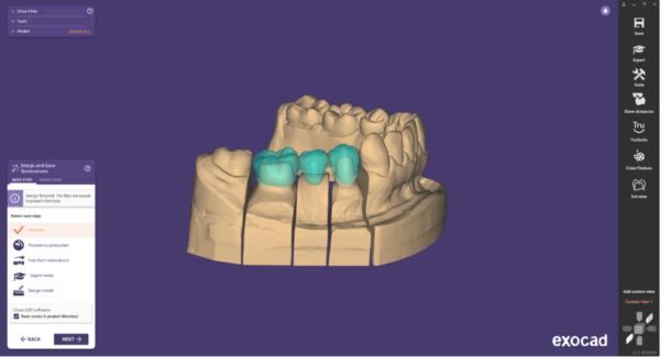 Exocad | Advanced CAD/CAM Software for Digital Dentistry