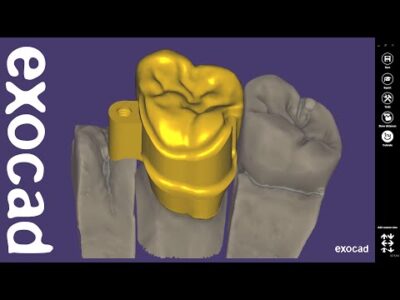 Exocad | Advanced CAD/CAM Software for Digital Dentistry